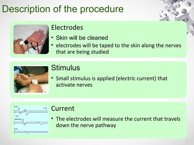 Nerves conduction study | PPT