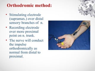 Nerves conduction study | PPT