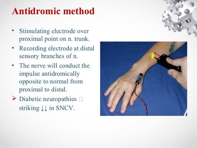 Nerves conduction study