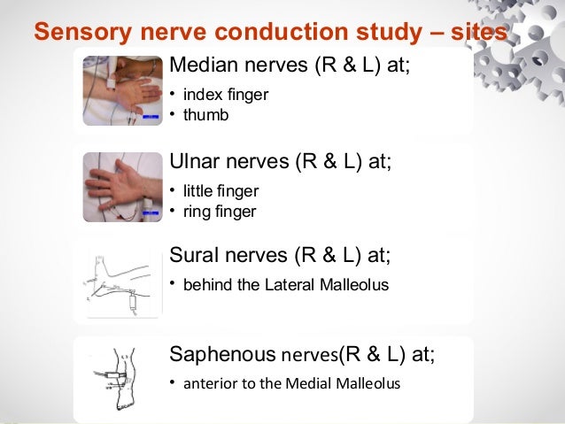 Nerves conduction study