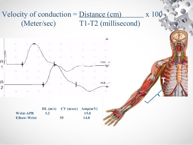 Nerves conduction study