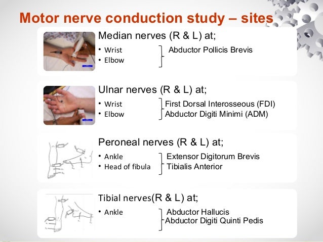 Nerves conduction study