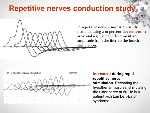 Nerves conduction study