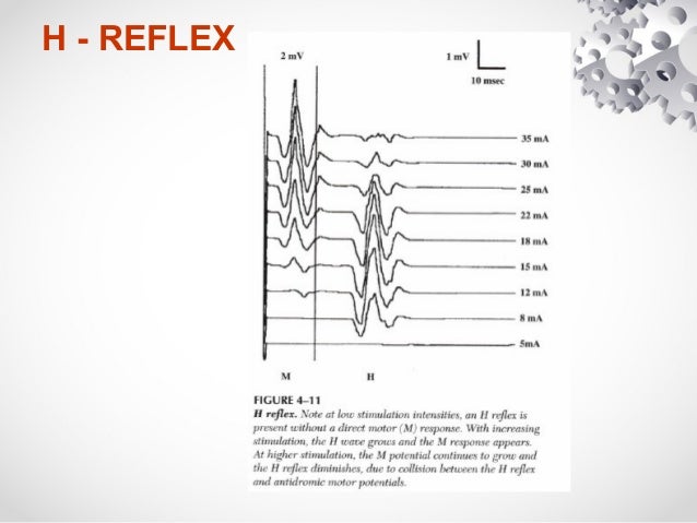 Nerves conduction study