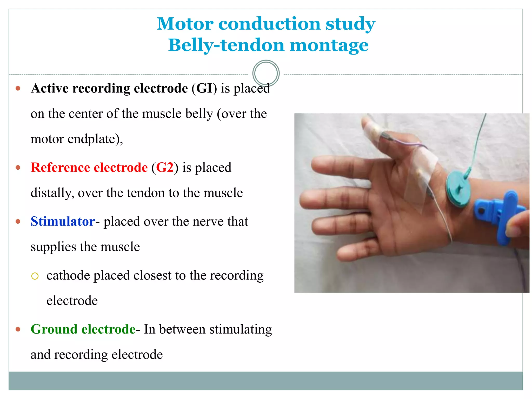 Nerves conduction study | PPTX