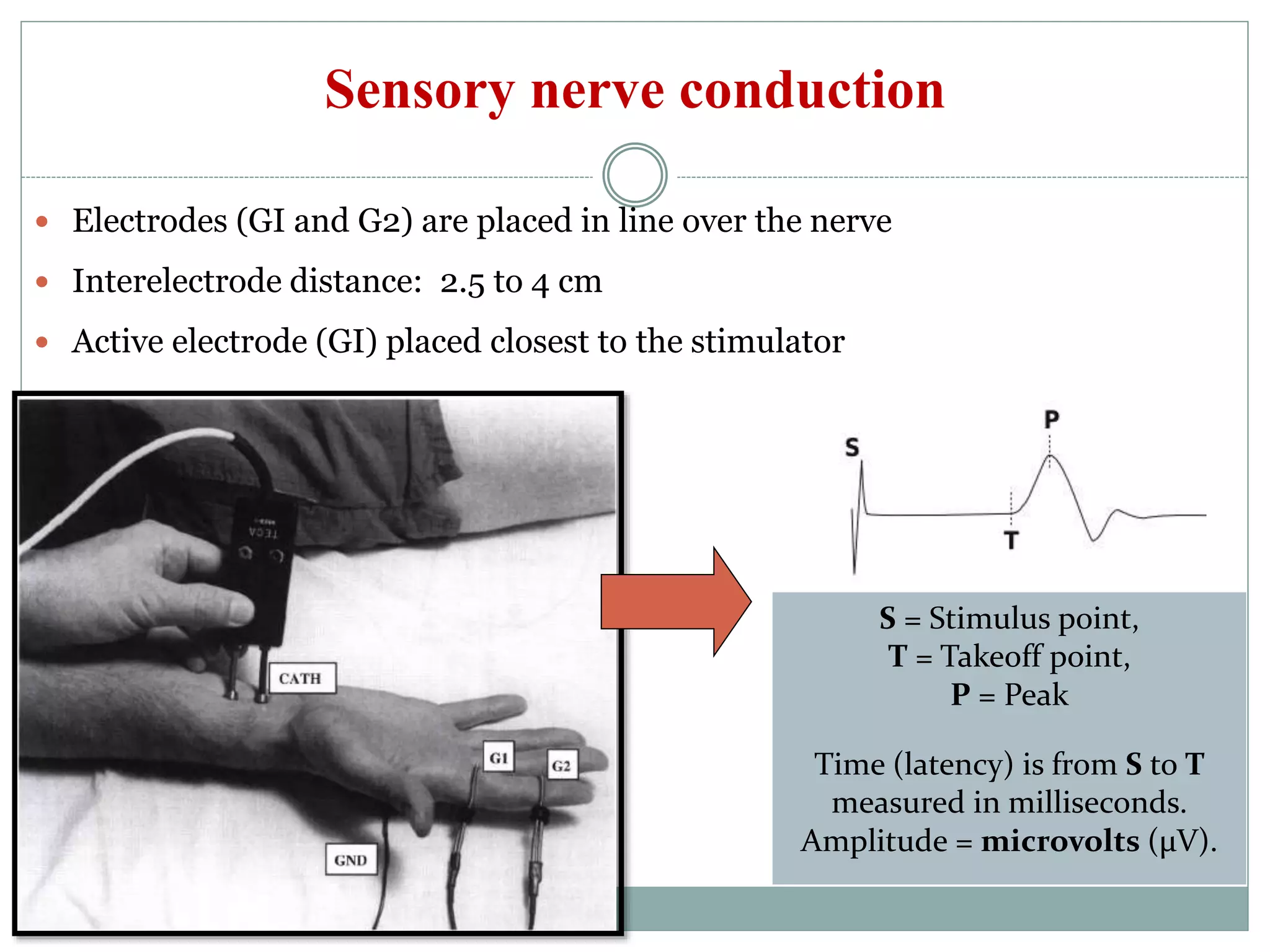 Nerves conduction study | PPTX