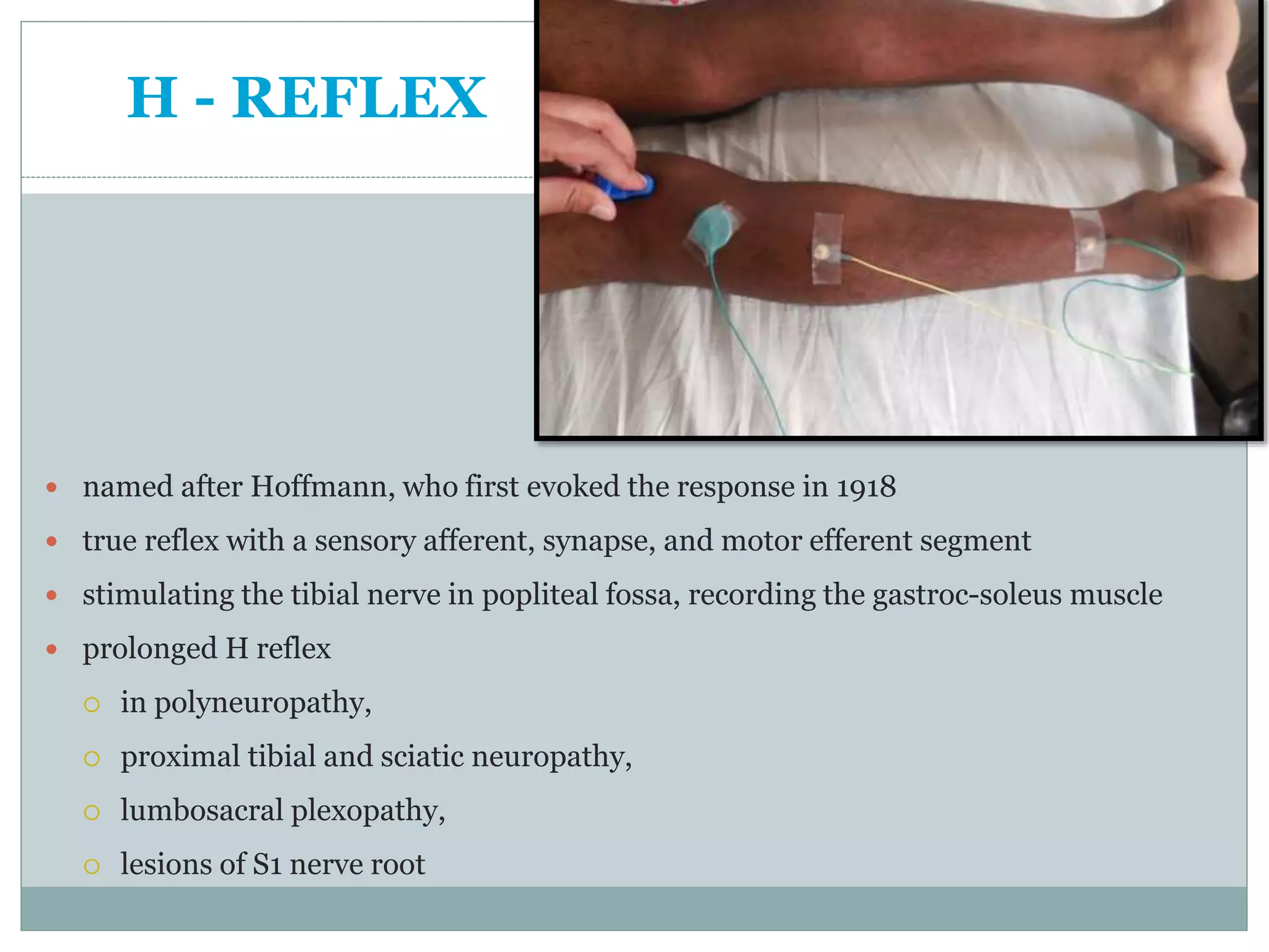 Nerves conduction study | PPTX