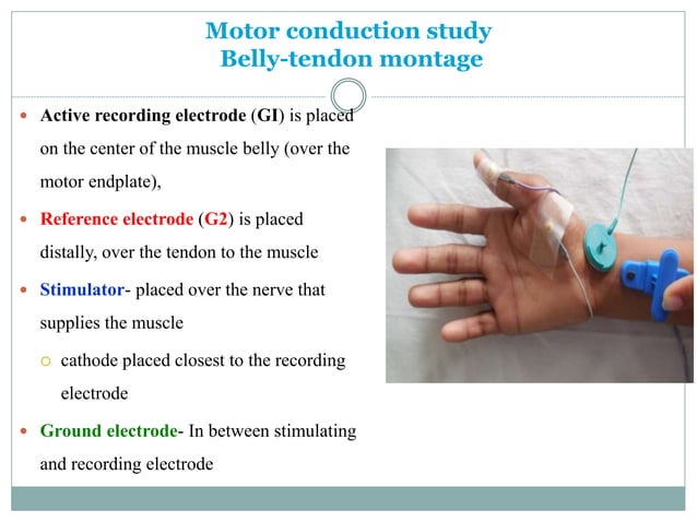 Nerves conduction study | PPTX