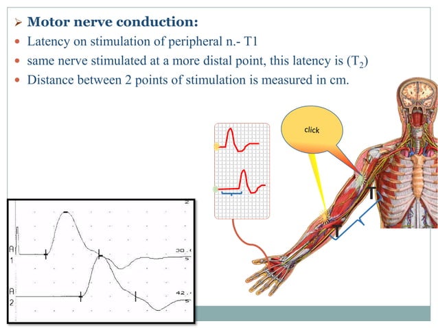 Nerves conduction study | PPTX