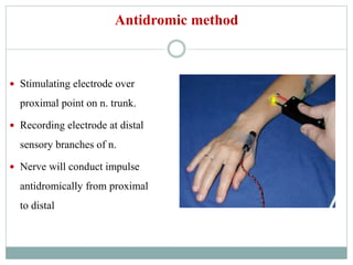 Nerves conduction study | PPTX