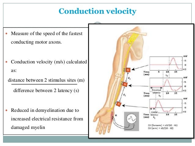 Nerves conduction study