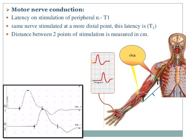 Nerve Conduction Study Video
