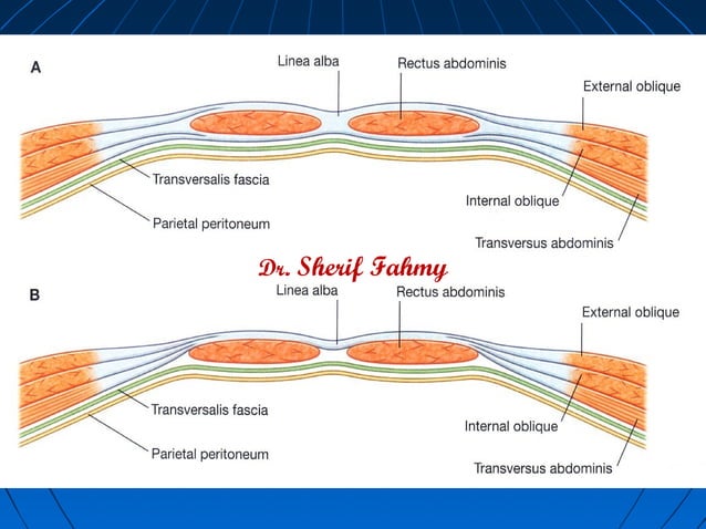 Nerves of Anterior Abdominal Wall (Anatomy of the Abdomen) | PPS