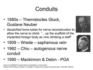 Nerve substitutes and advances in nerve reconstruction | PPT