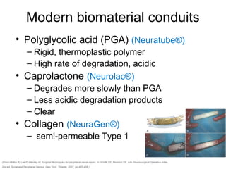 Nerve substitutes and advances in nerve reconstruction | PPT