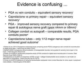 Nerve substitutes and advances in nerve reconstruction | PPT