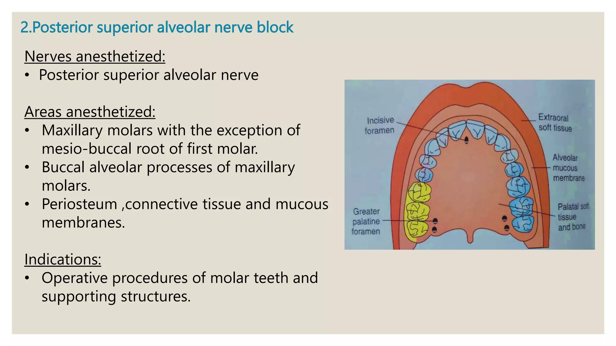 Nerve supply and anesthesia in maxillary arch.pptx