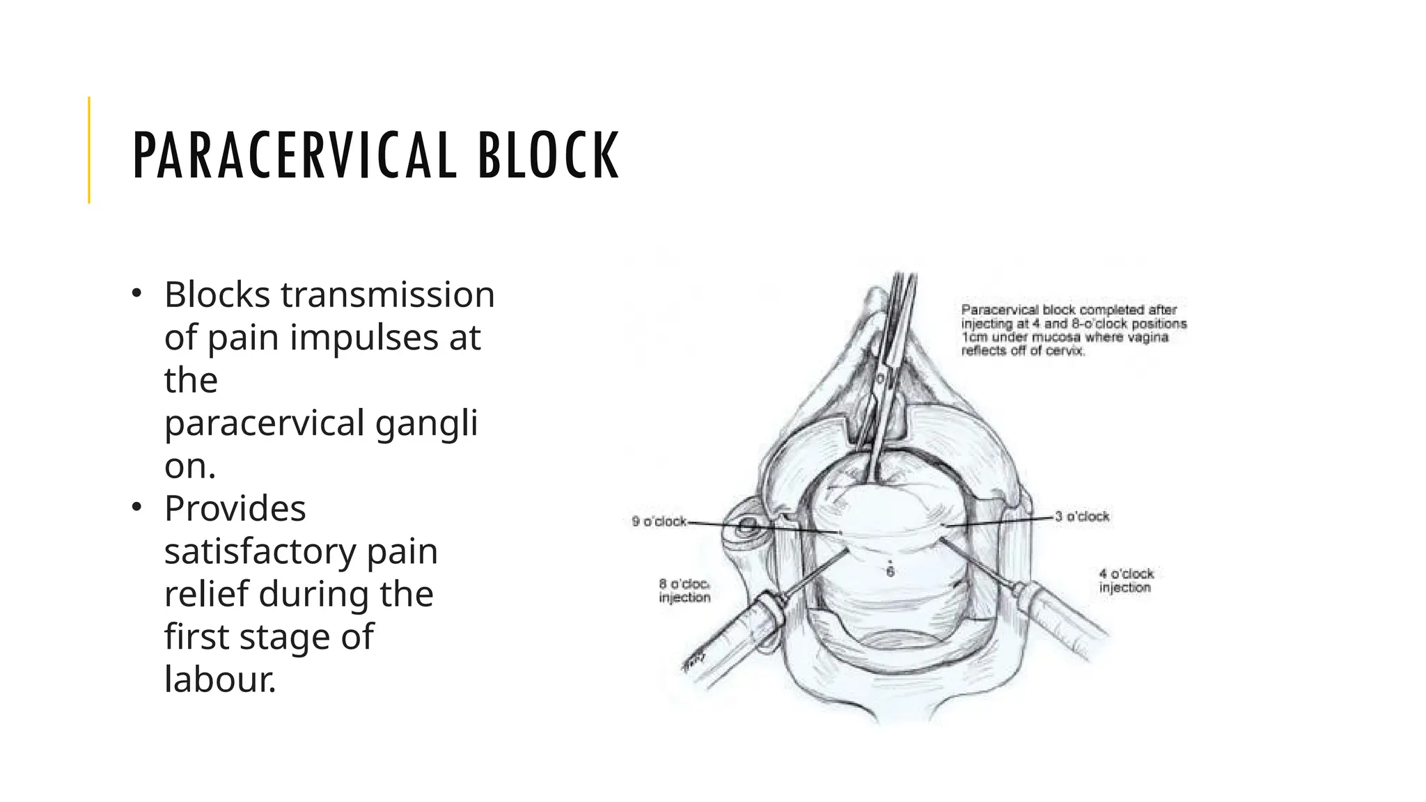 Nerve Supply of female genital tract edited.pptx