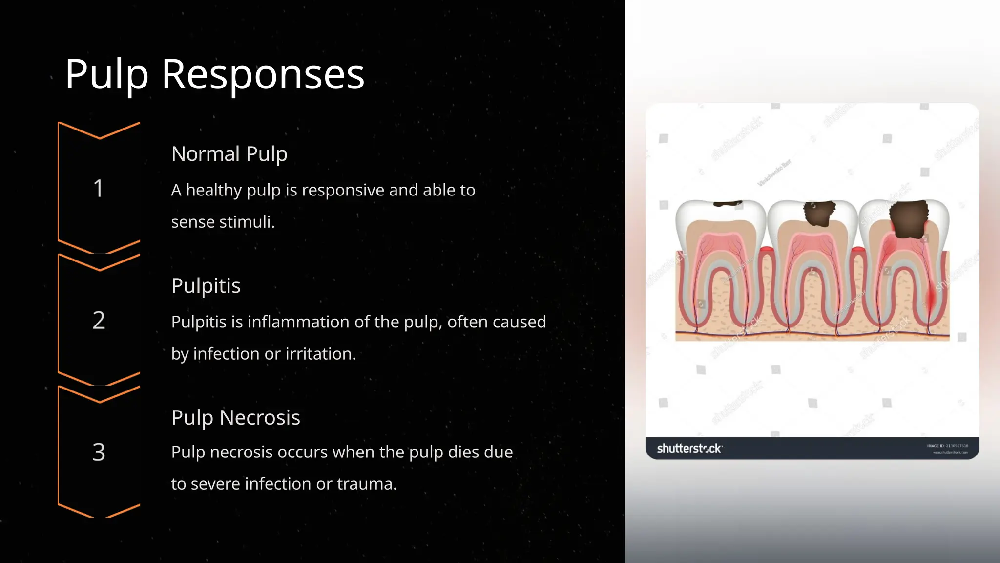 Nerve supply of teeth dental histology dental anatomy.pptx