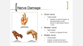 nerves vessels hand.pptx anatomy of hand | PPTX