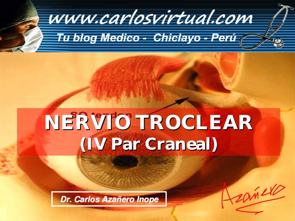 Nervio Troclear