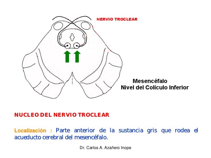 Nervio Troclear