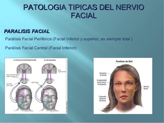 VII Par Craneal Nervio Facial