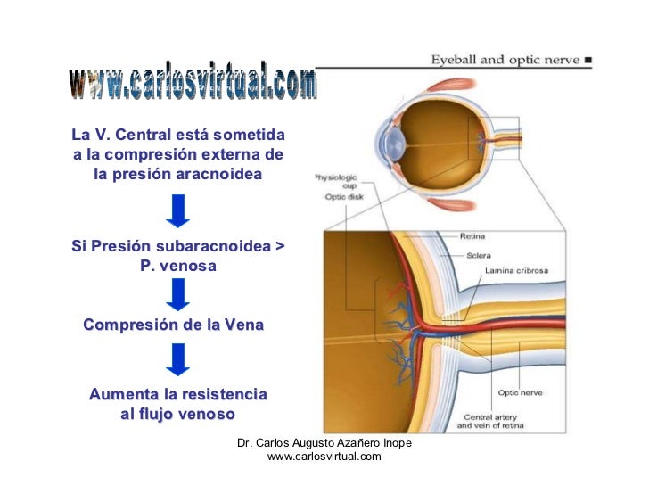 Anatomía Del Nervio óptico