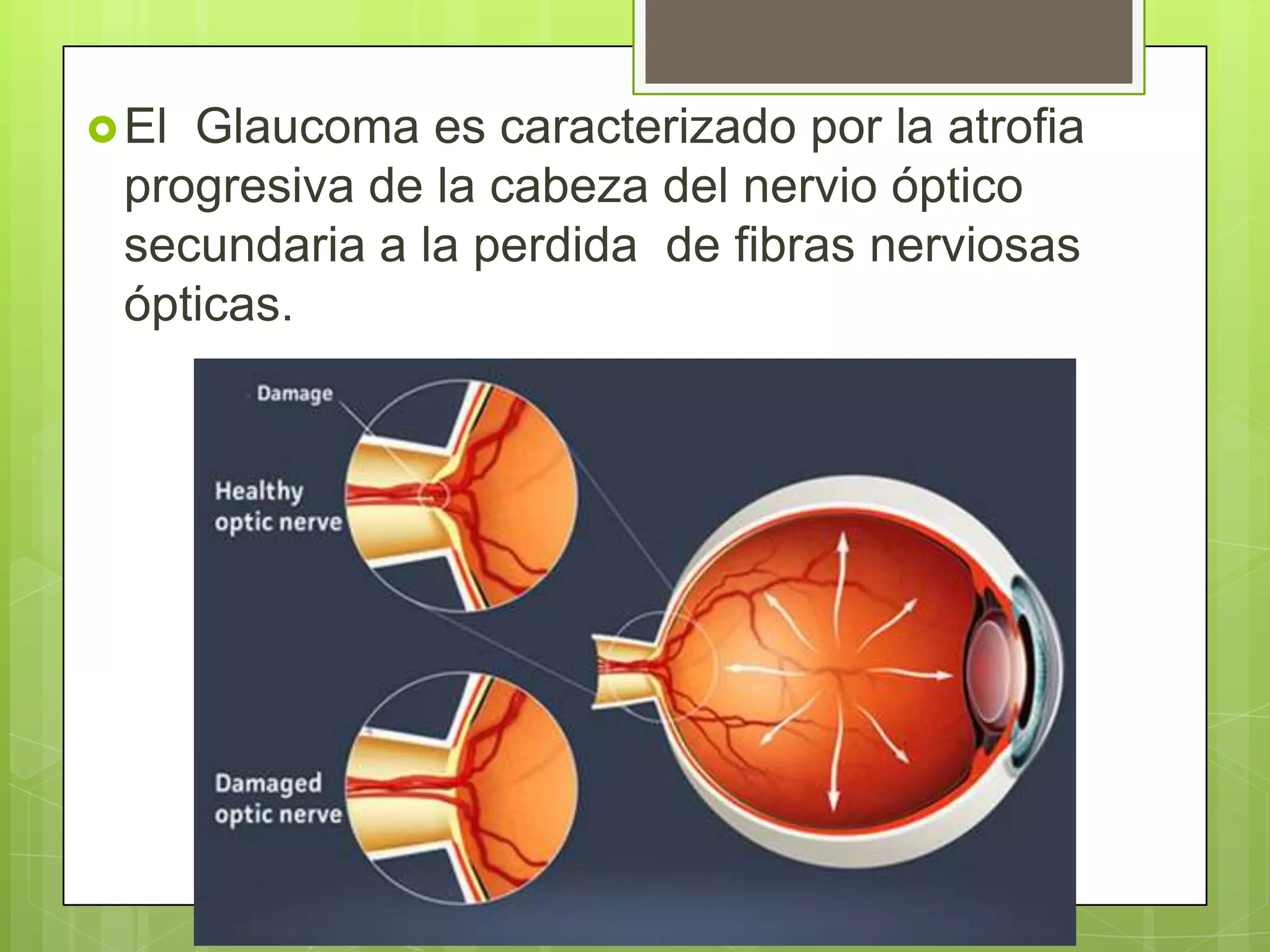 Nervio óptico, retina y coroides | PPT
