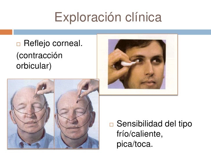 Exploración clínica de pares craneales