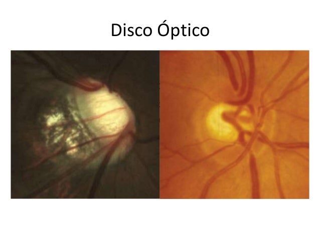 Nervo óptico Anatomia Básica E Aplicação Clínica