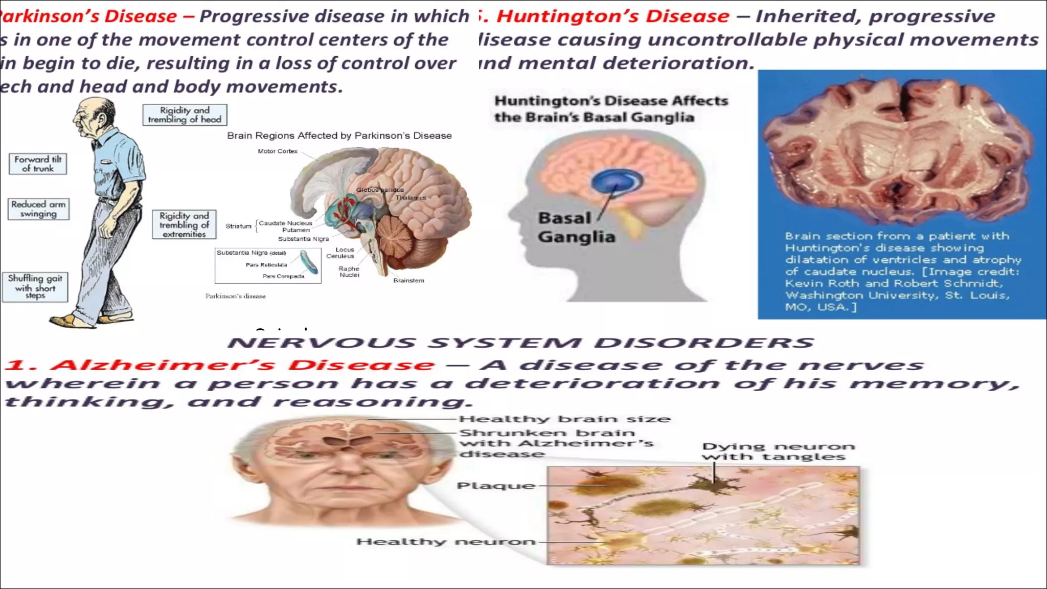 Nervous system.pdf | Brain and Nervous System Disorders | Diseases and ...