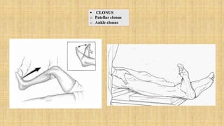 Nervous system examination | PPTX