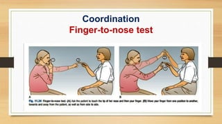 Finger To Nose Test