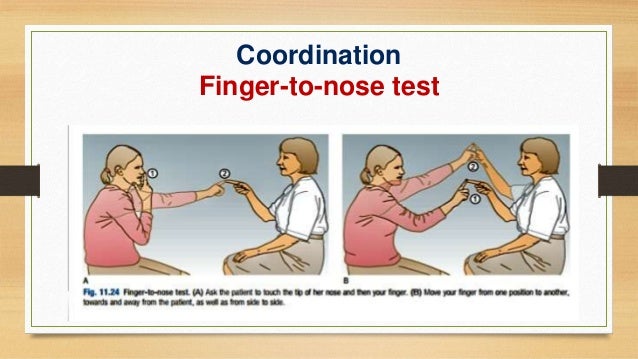 Nervous system exam part 2