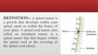 Nervous System (Part 3) Spinal Cord and It's Disease Condition | PPTX