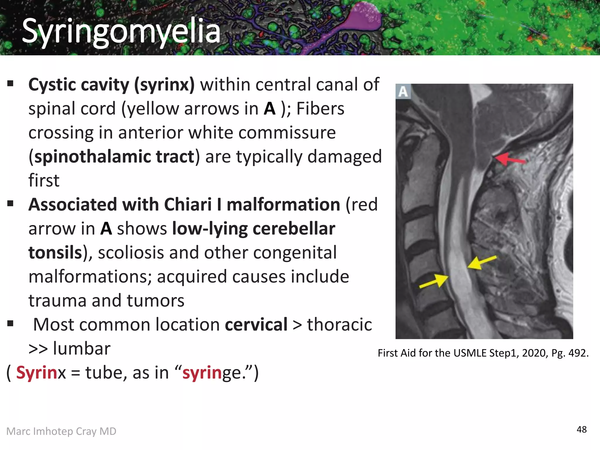 Nervous System Pathology_A Case-based Learning Approach | PDF