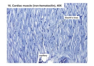 Nervous tissue ii | PPT