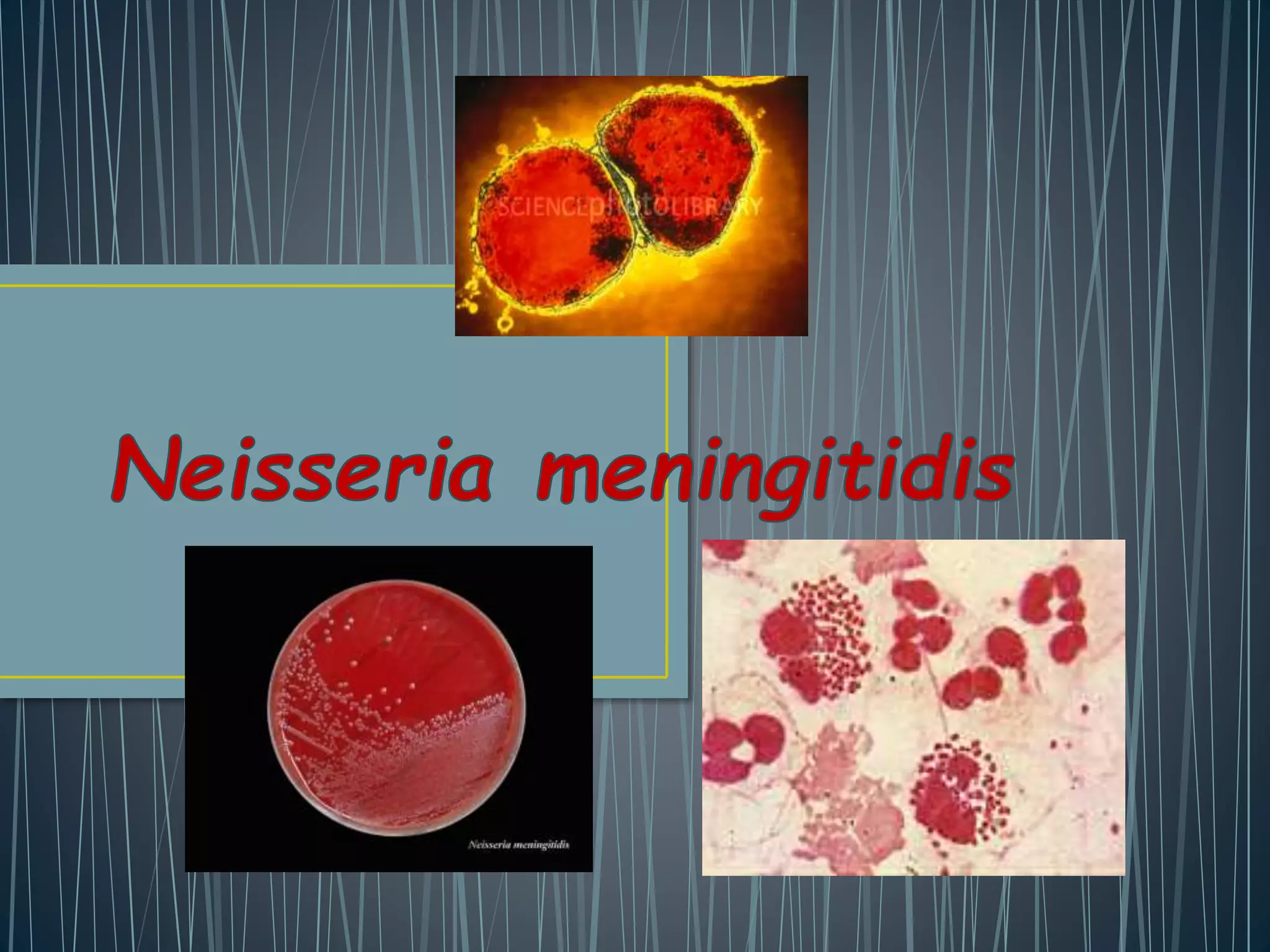Nesisseria gonorrhoeae y neisseria meningitidis | PPT