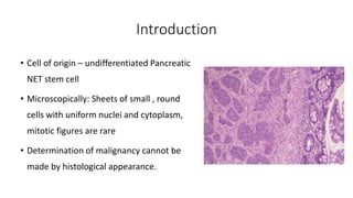 NeuroEndocrineTumours PANCREAS full.pptx