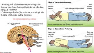 Neu_Exami_Mental status examination 2023_tkđq.pptx