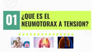 neumo%20a%20tension.pdf