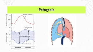 neumo%20a%20tension.pdf