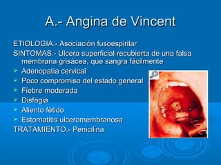 Neumocardiología anginas e infecciones virosicas de vías aéreas | PPT