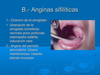 Neumocardiología anginas e infecciones virosicas de vías aéreas | PPT