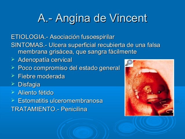 Neumocardiología anginas e infecciones virosicas de vías aéreas