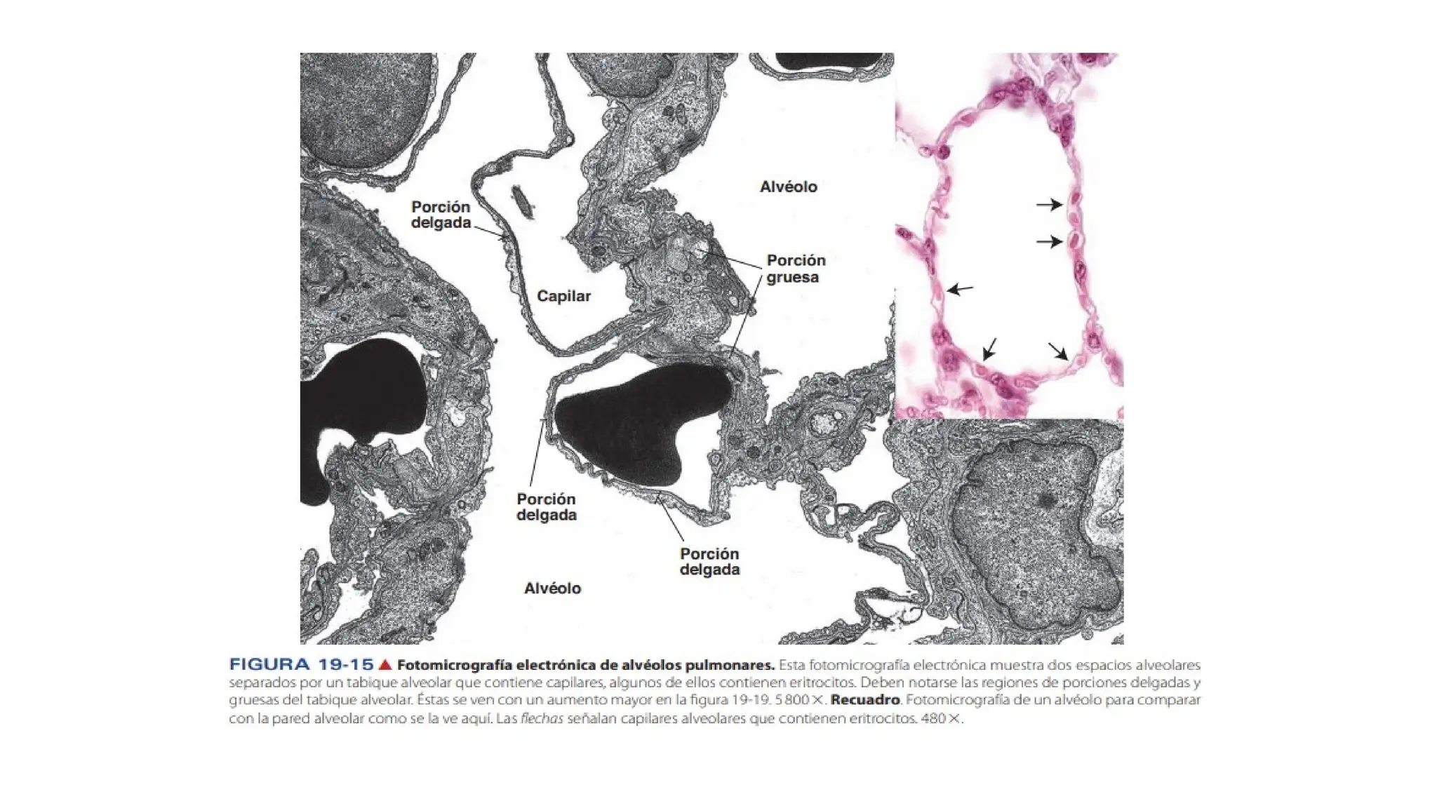HISTOLOGIA NEUMOCITOS TIPO I Y TIPO II.pptx