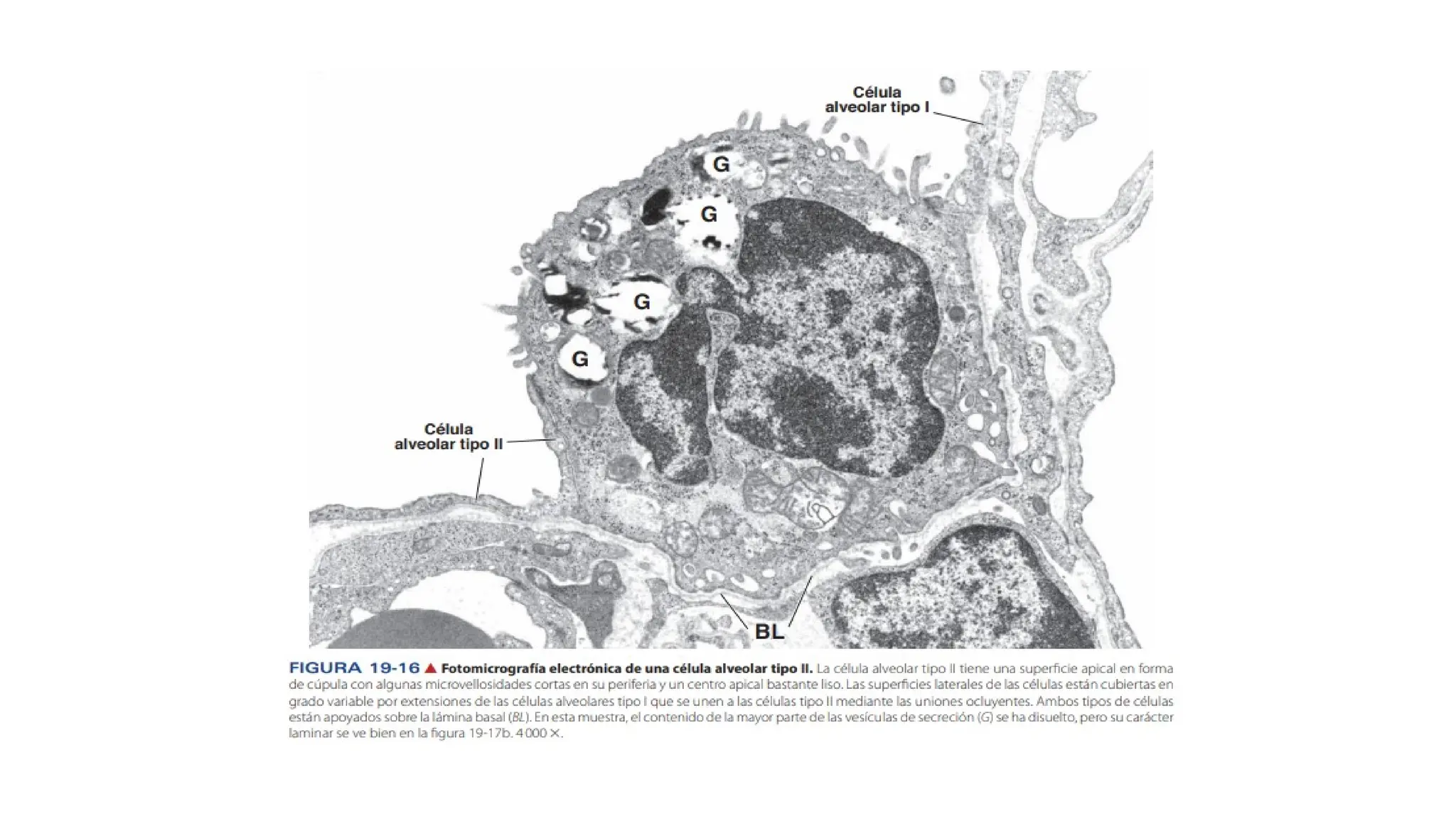 HISTOLOGIA NEUMOCITOS TIPO I Y TIPO II.pptx
