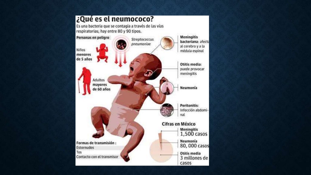 Neumococo, que es?, tratamiento, causas, caracteristicas, etc