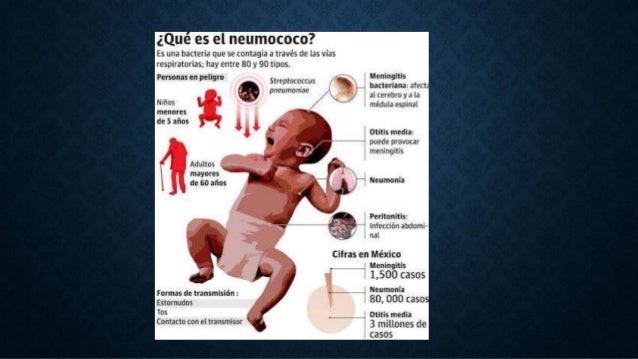 Neumococo, que es?, tratamiento, causas, caracteristicas, etc